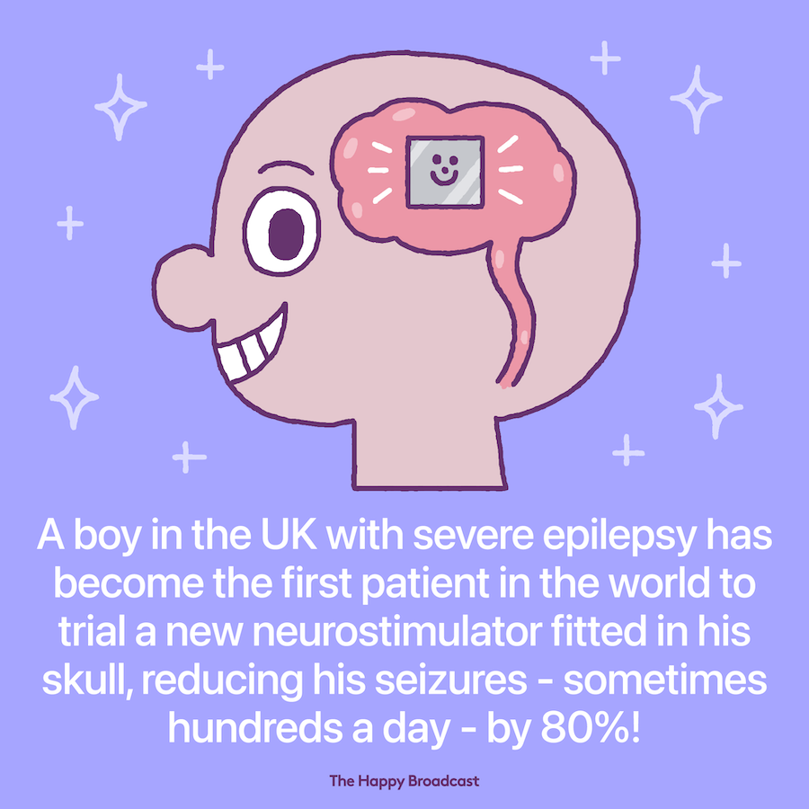 Boy becomes first person fitted with brain implant to control epileptic ...