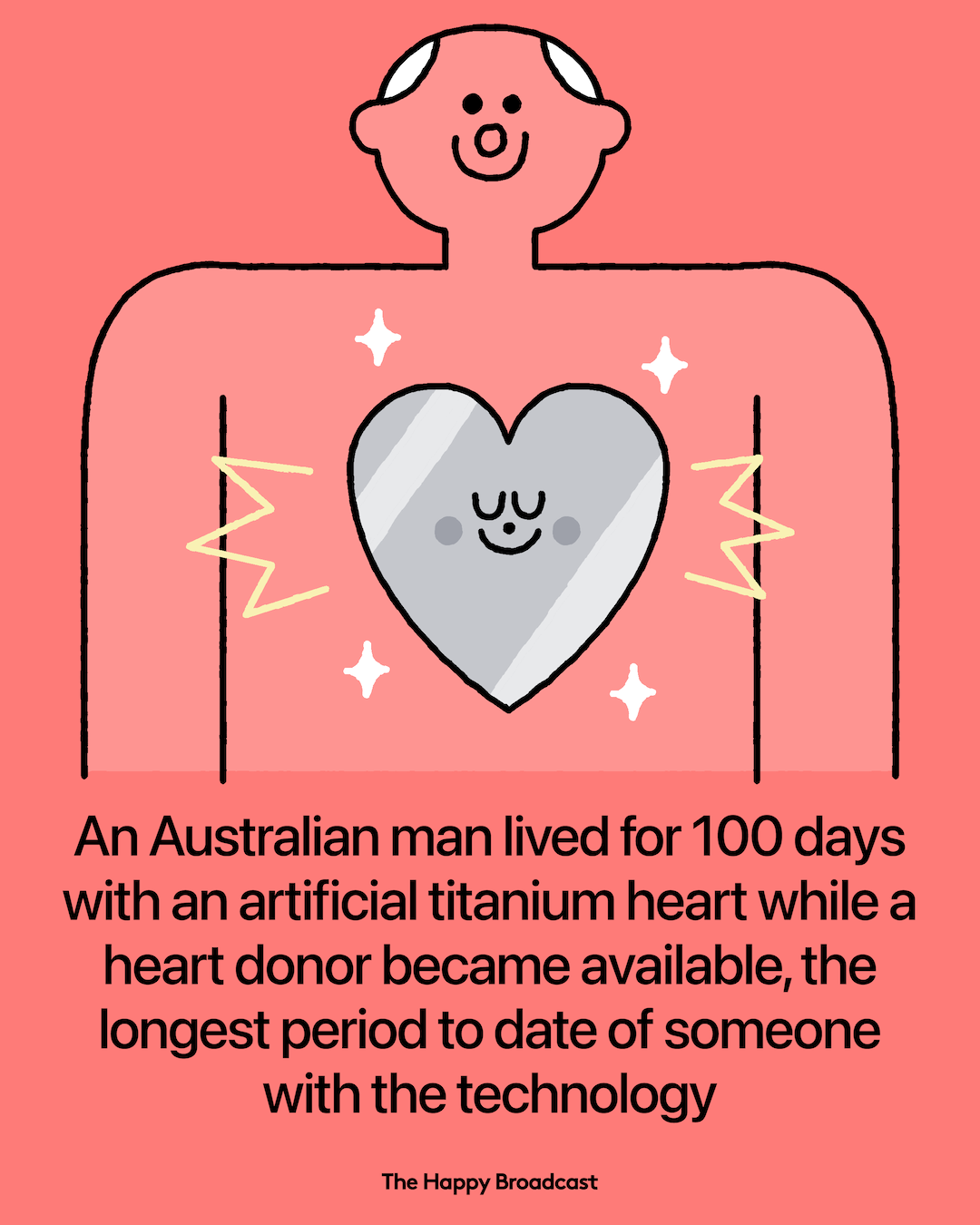 Man Survives with Titanium Heart for 100 Days - The Happy Broadcast